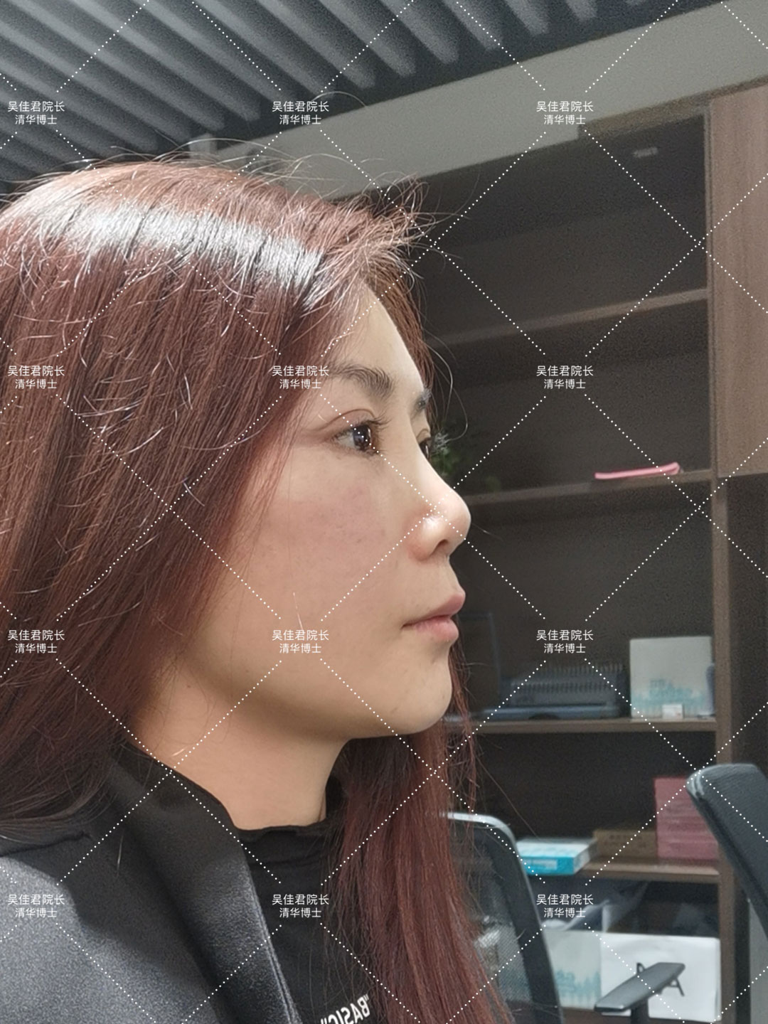 In her 30s, her face collapsed like a 50-year-old aunt. She ...