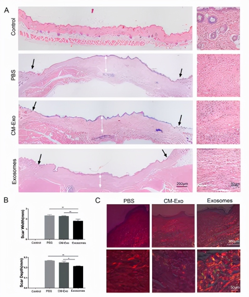 Application of stem cell exosomes in the field of skin diseases: wound ...