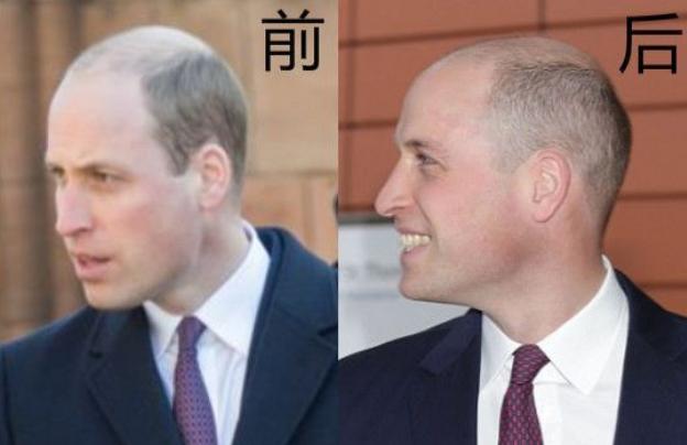 The prince is "bald", and the princess has bulging mouth and buck teeth ...