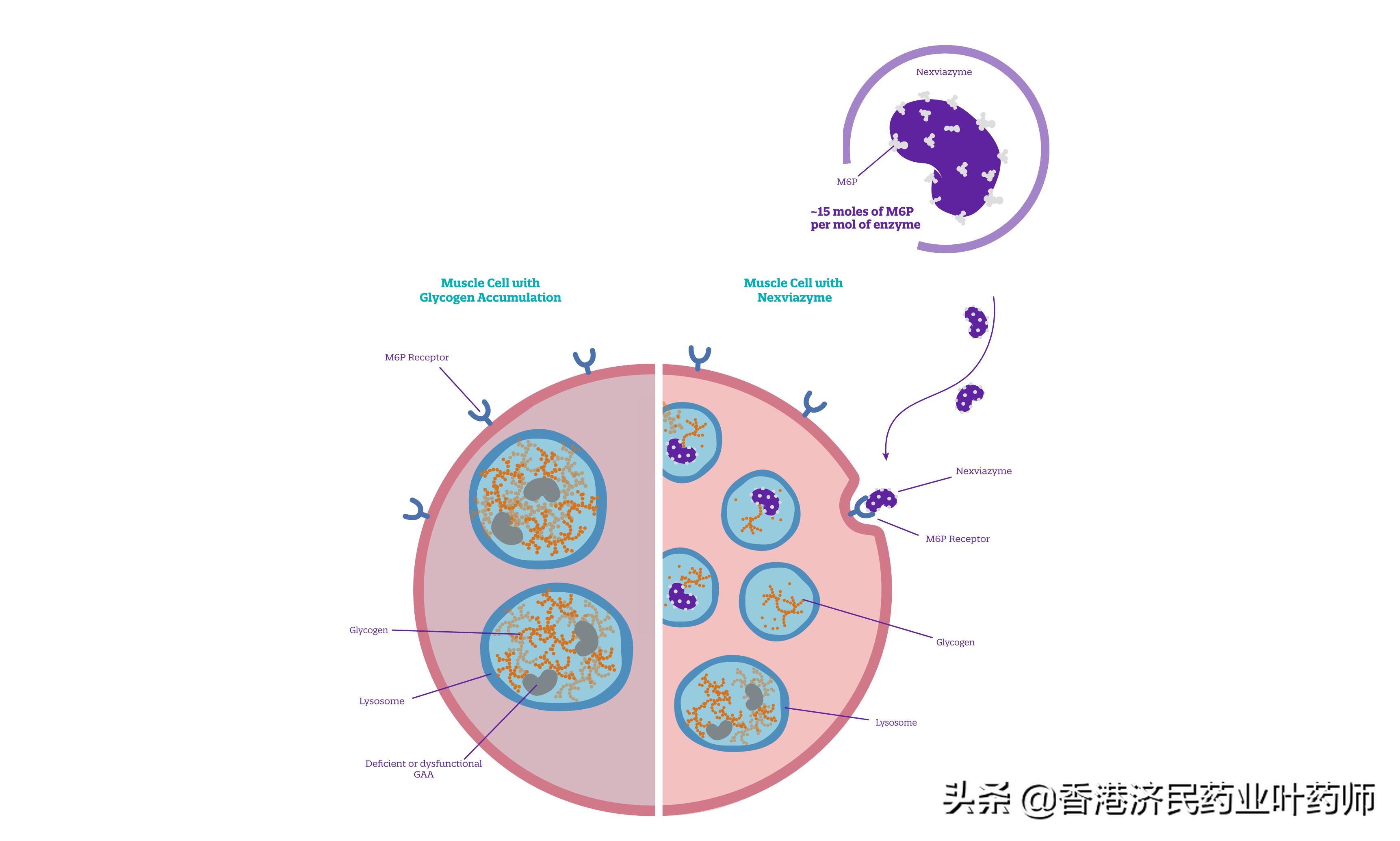 New drugs for rare diseases!Late-onset Pompe disease enzyme replacement ...