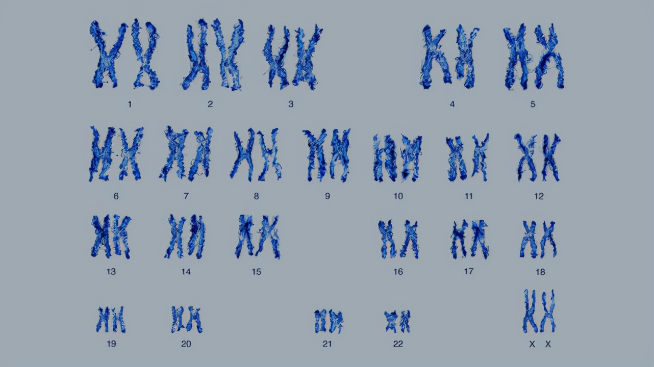 What happens if a man has an extra Y chromosome?1 in 1,000, more man ...