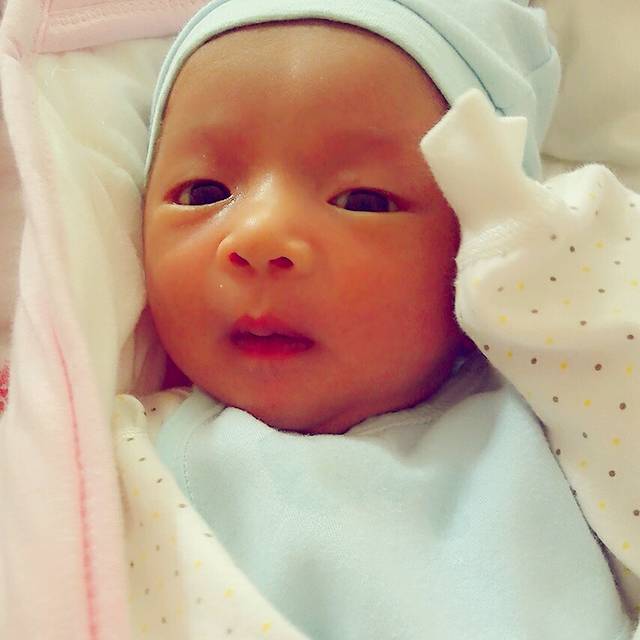 The baby's face has these 3 characteristics, which means it is a ...