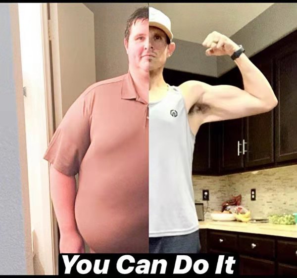 A man who lost 290 pounds in four years: can't take a shower normally ...