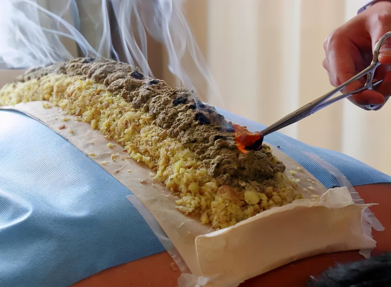 Have you ever heard of moxibustion for health preservation and health ...