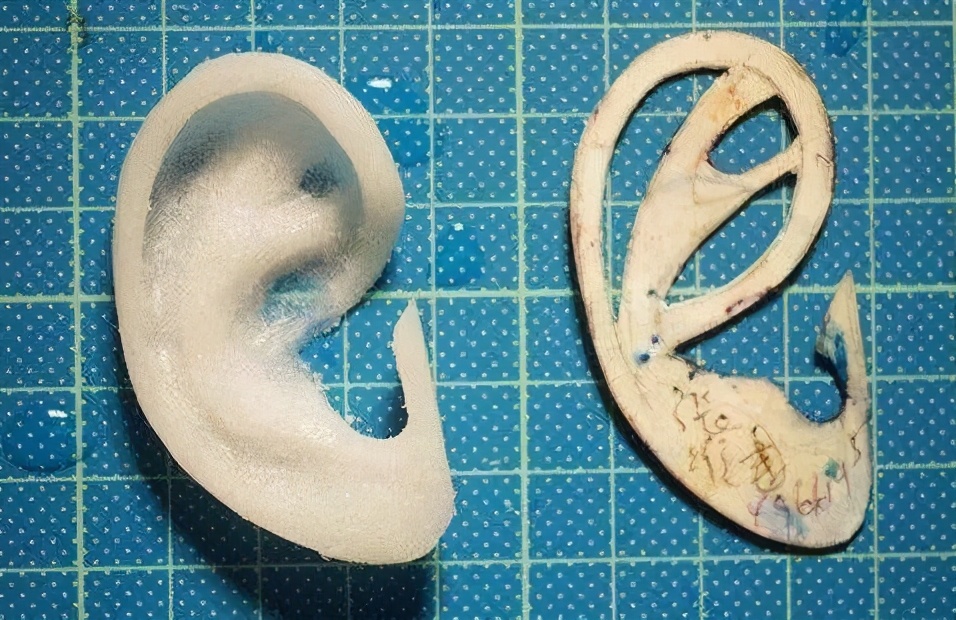 What if there are no ears?Understand ear reconstruction - iNEWS