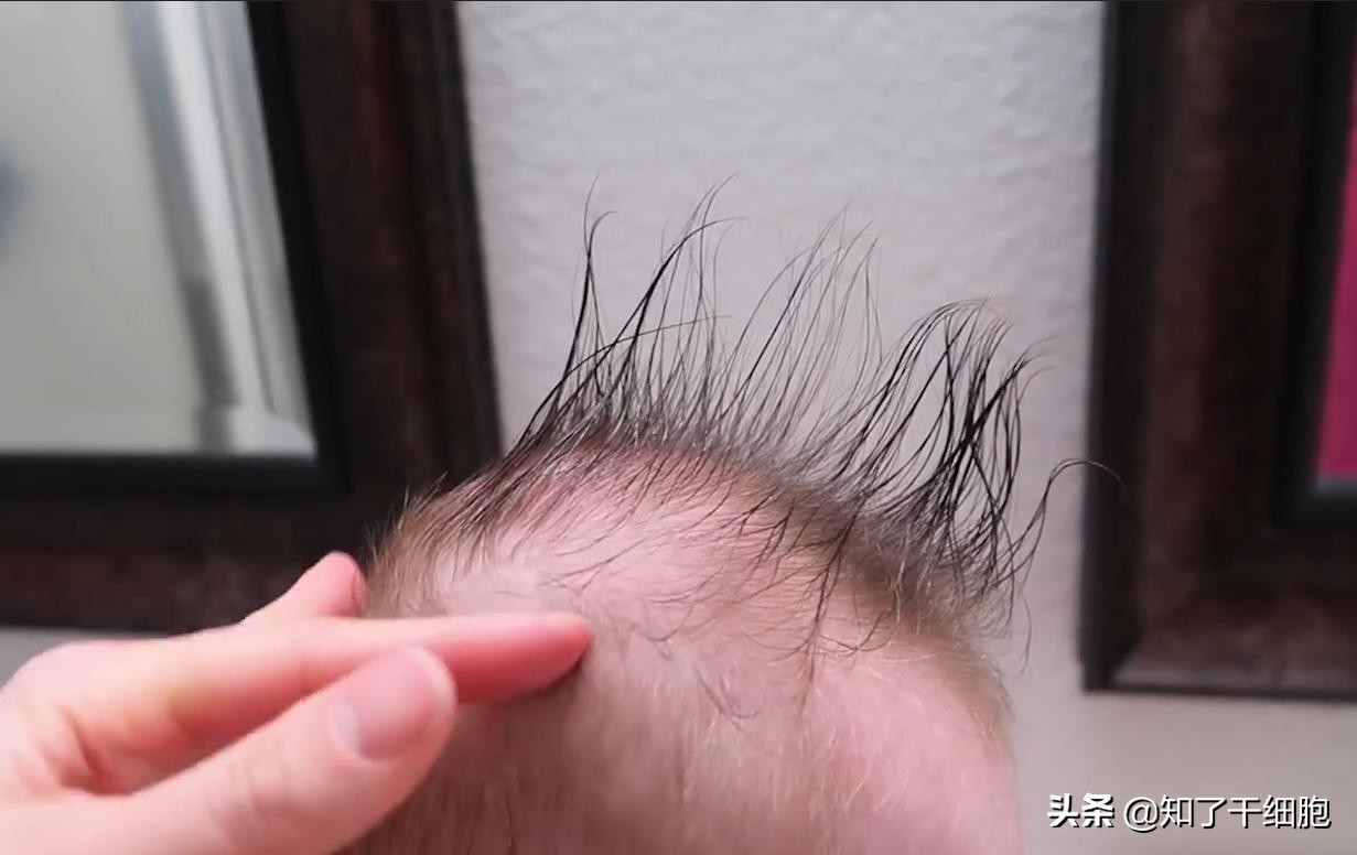 The disadvantages of shaving lanugo are so many!To make your baby's ...