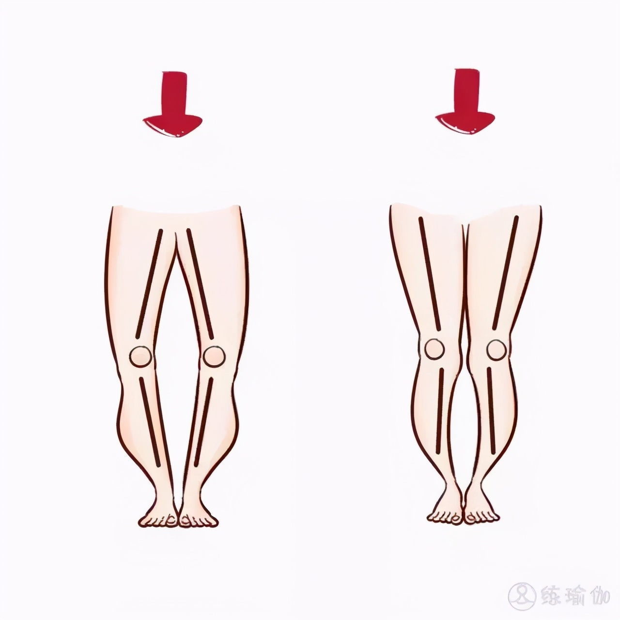 Small thick legs self-test: Are you an XO leg?YES OR NO - iNEWS