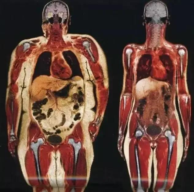 How do women's stout figures become slim? - iNEWS