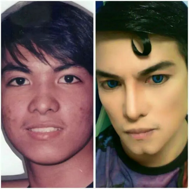 The Philippine guy had 23 plastic surgery and became Superman, and he ...