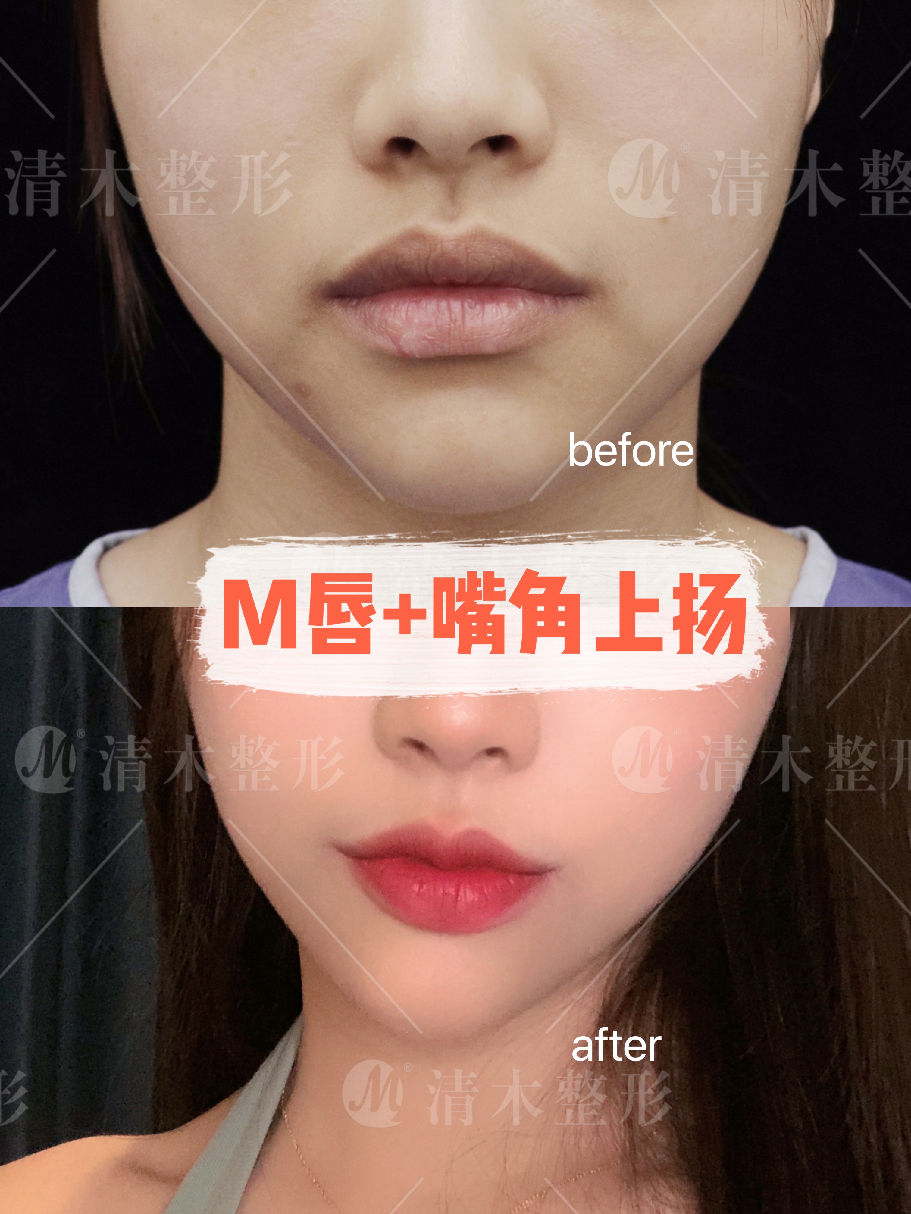 m lip + mouth corners up - iNEWS