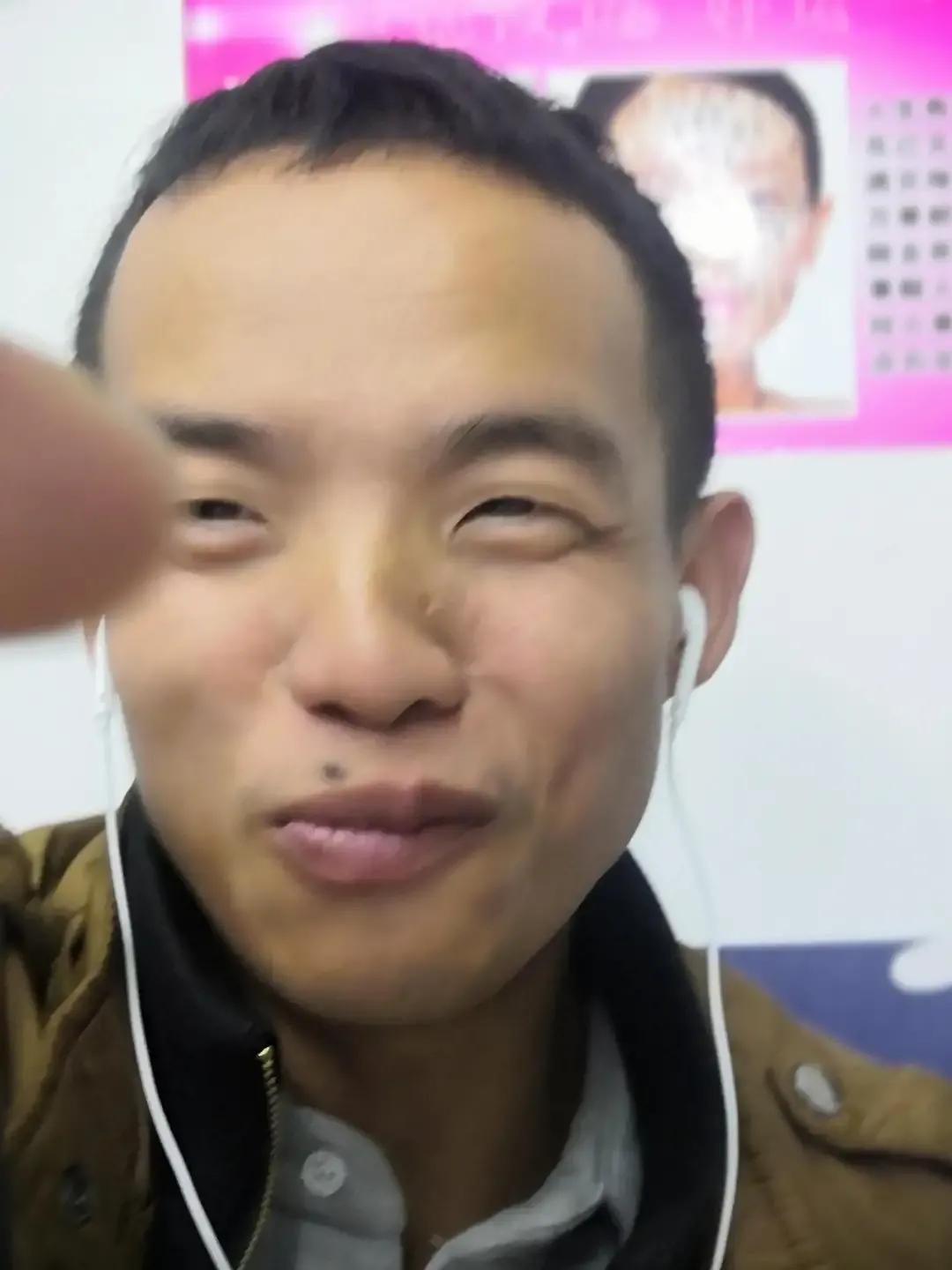 The most disgusting person in the world The ugliest and most disgusting ...