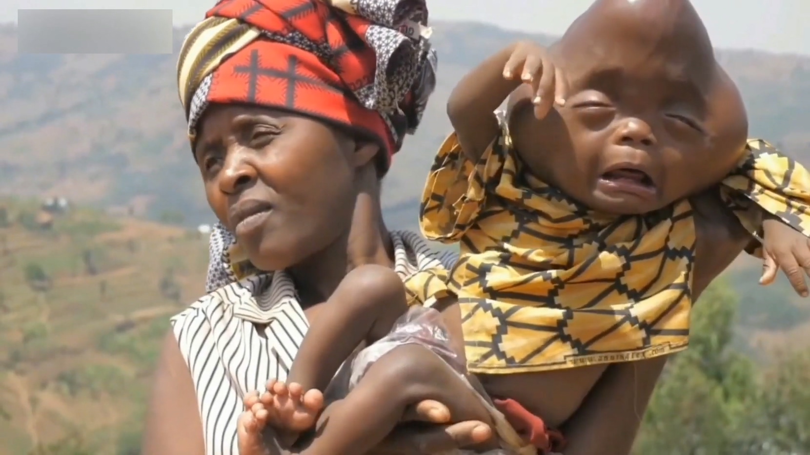 A strange baby in Rwanda, Africa, with a triangular head resembling an ...