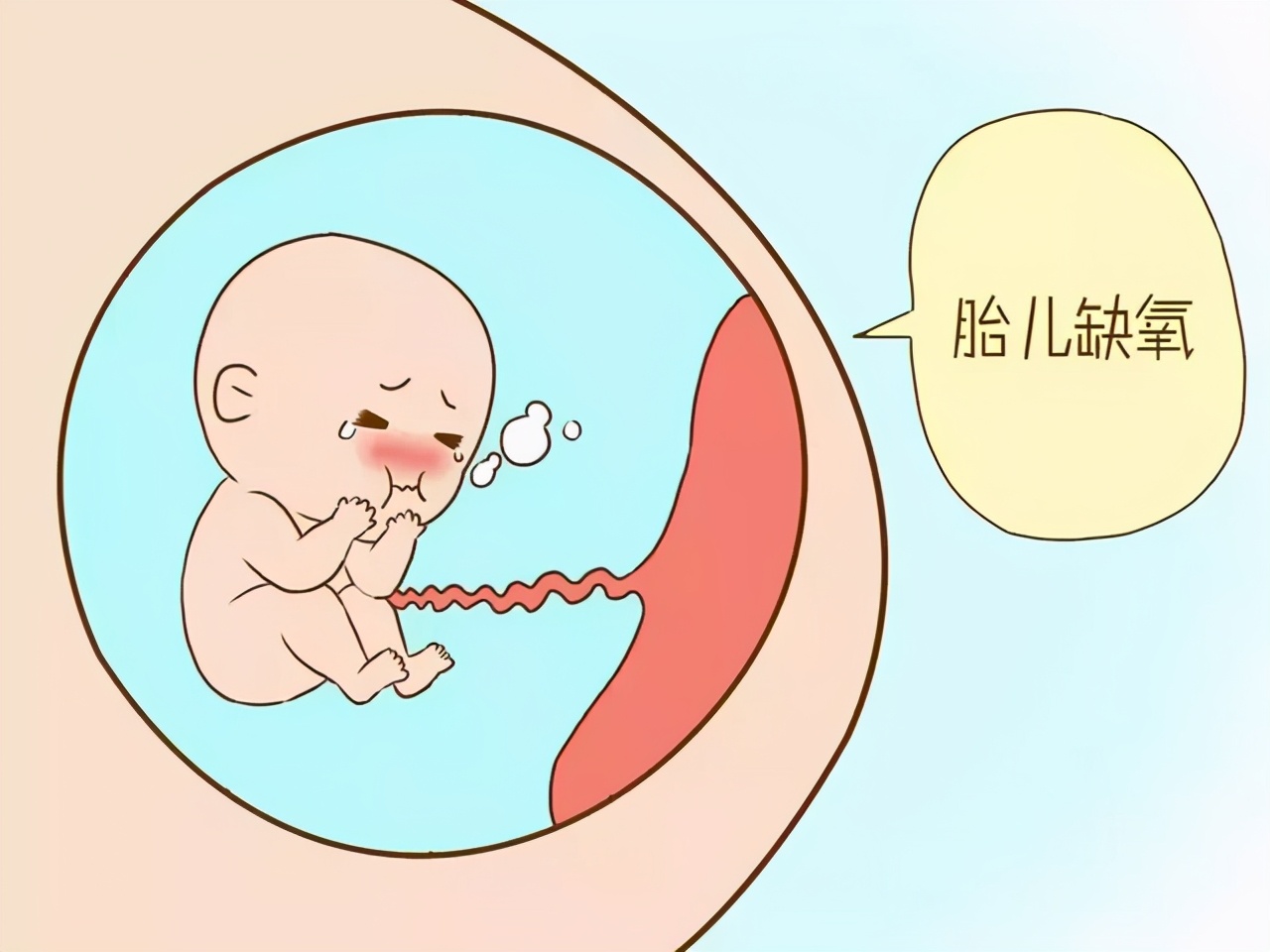 Certain situations during pregnancy indicate that the fetus is hypoxic ...