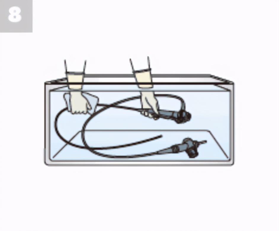 Bronchoscope cleaning guide (OLYMPUS) - iNEWS