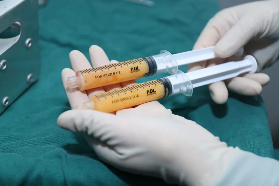 Do I have to directly inject the filling after I have done the ...