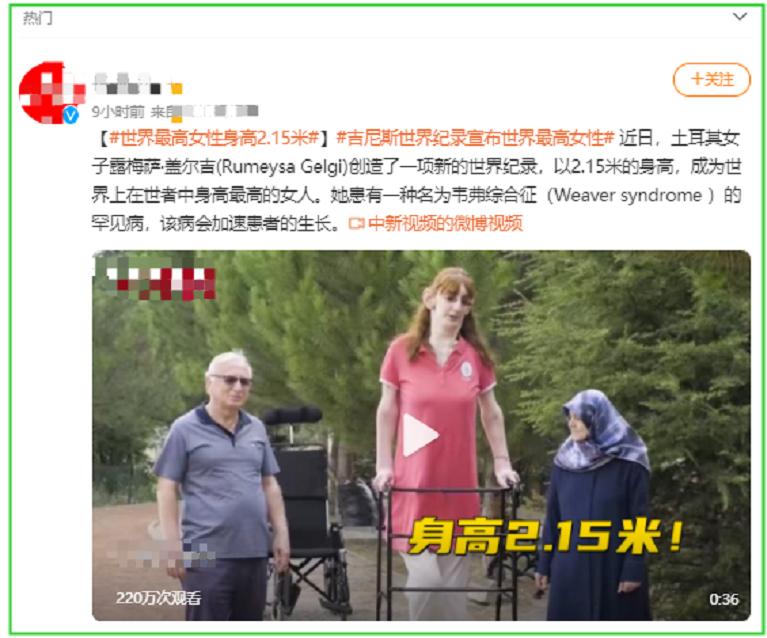 The tallest woman in the world is 2.15 meters tall, breaking the ...