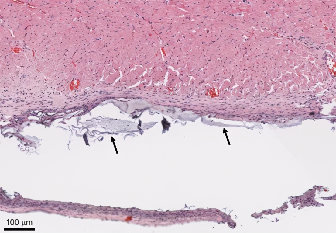 "Nature·Communication" Catechol-functionalized oxime cross-linked PEG ...