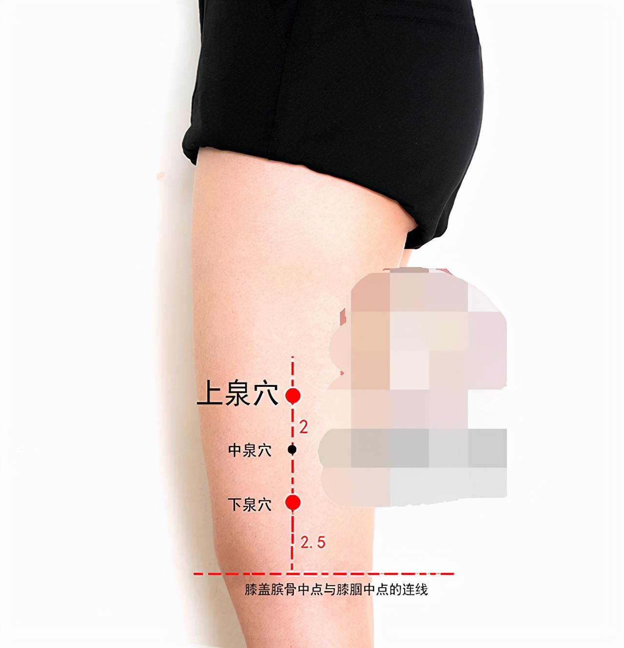 TCM acupuncture and upper extremity disease prescription 6 - iNEWS