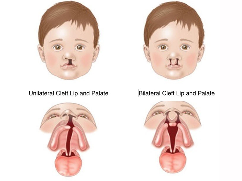 "Following" is a 14-year-old Li Wei picking up the rabbit lip, the ...
