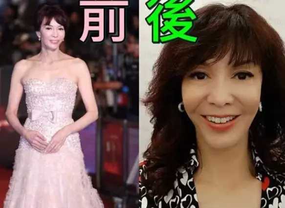 Zheng Yuling failed plastic surgery again and raised her boyfriend for ...