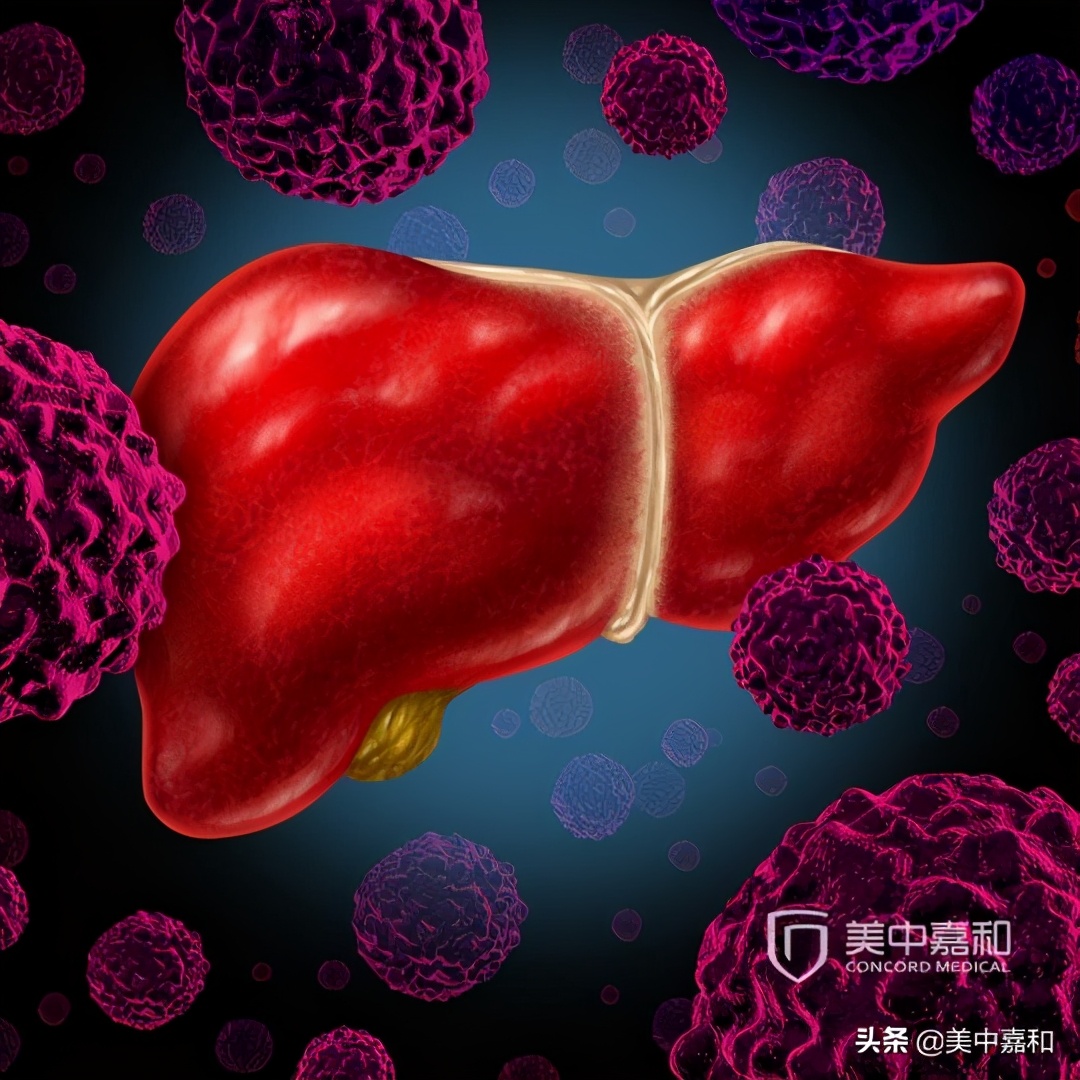 Wu Mengda was diagnosed with liver cancer after Zhao Yingjun. Why are ...