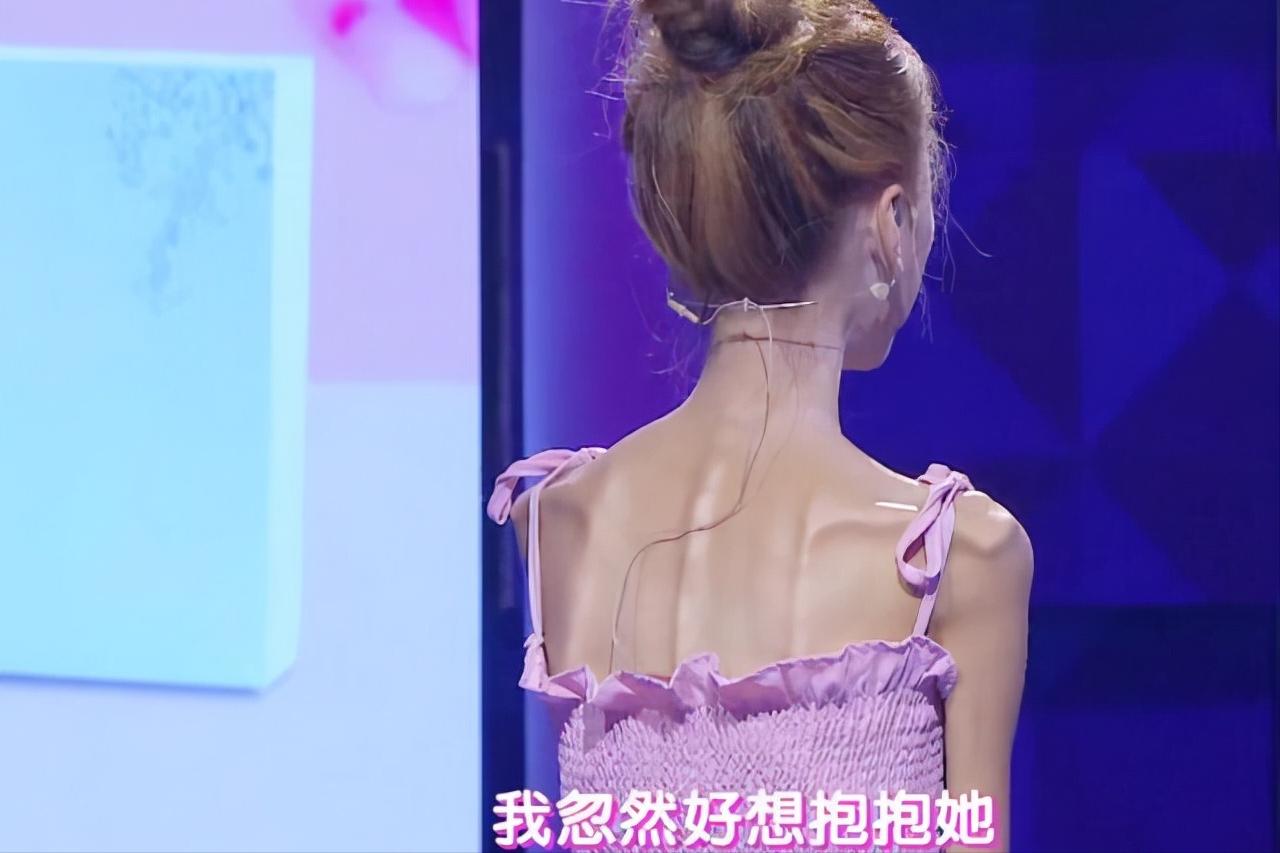Millions of internet celebrities are so thin and skinny that it's not ...
