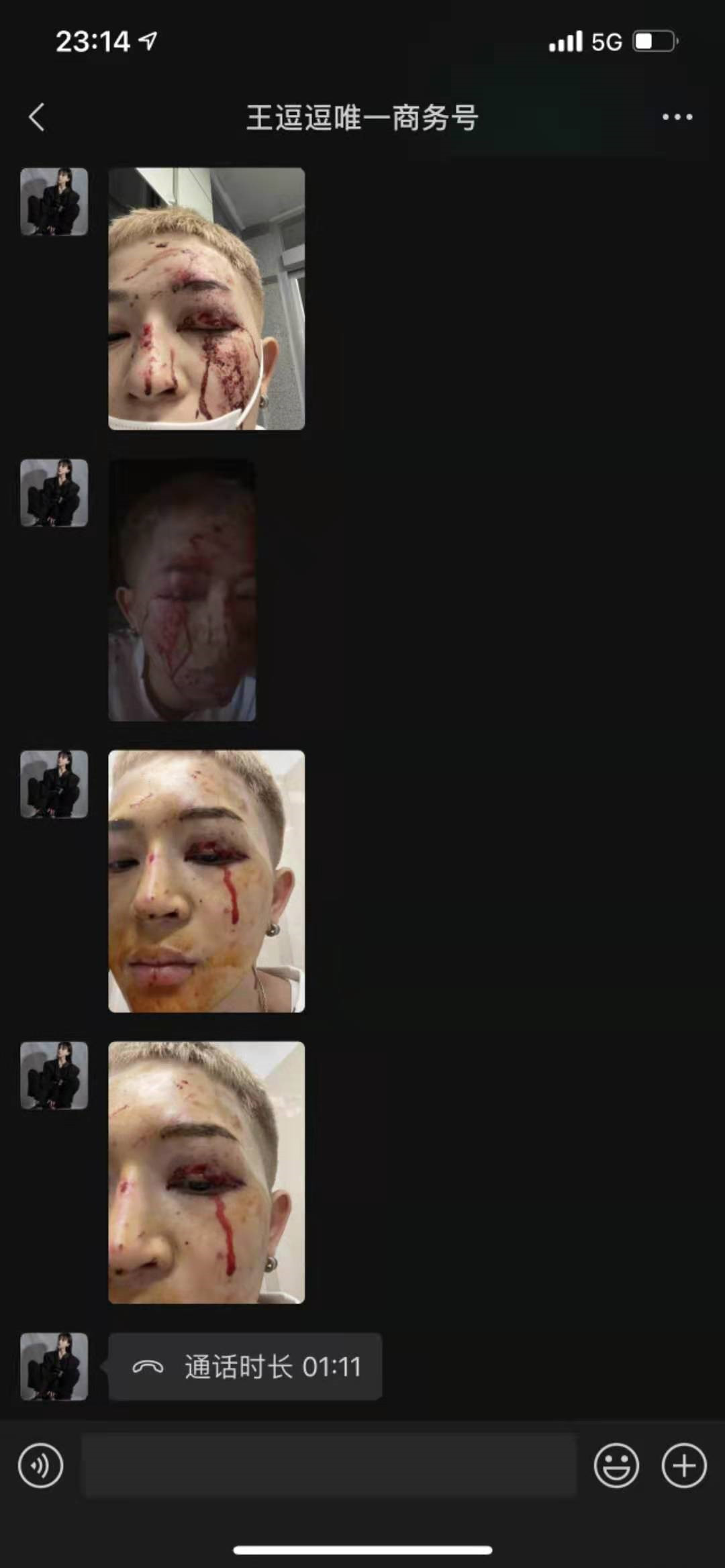 Wang Doudou took photos of his lover's car accident, his eyelids were ...