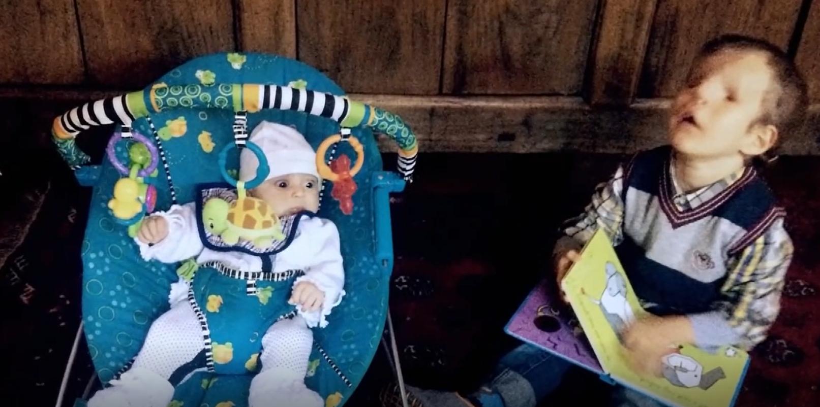 The boy was born without a face. After 19 hours of surgery, his parents ...