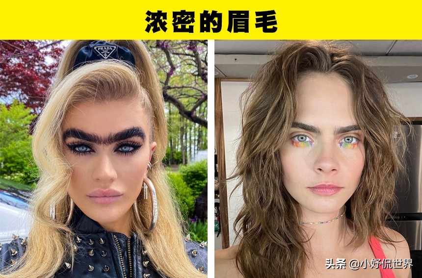 7 models who stood out because of the so-called "physical defects" - iNEWS