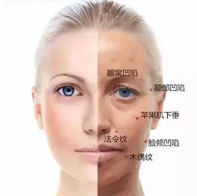 Facial depression, sagging skin, like a dehydrated raisin, what should ...