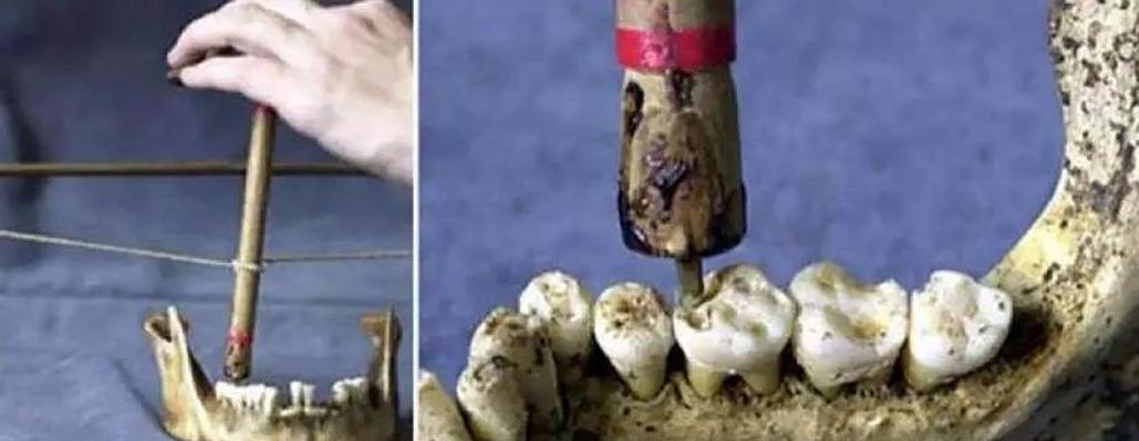 How did European farmers clean their teeth in the Middle Ages? - iNEWS