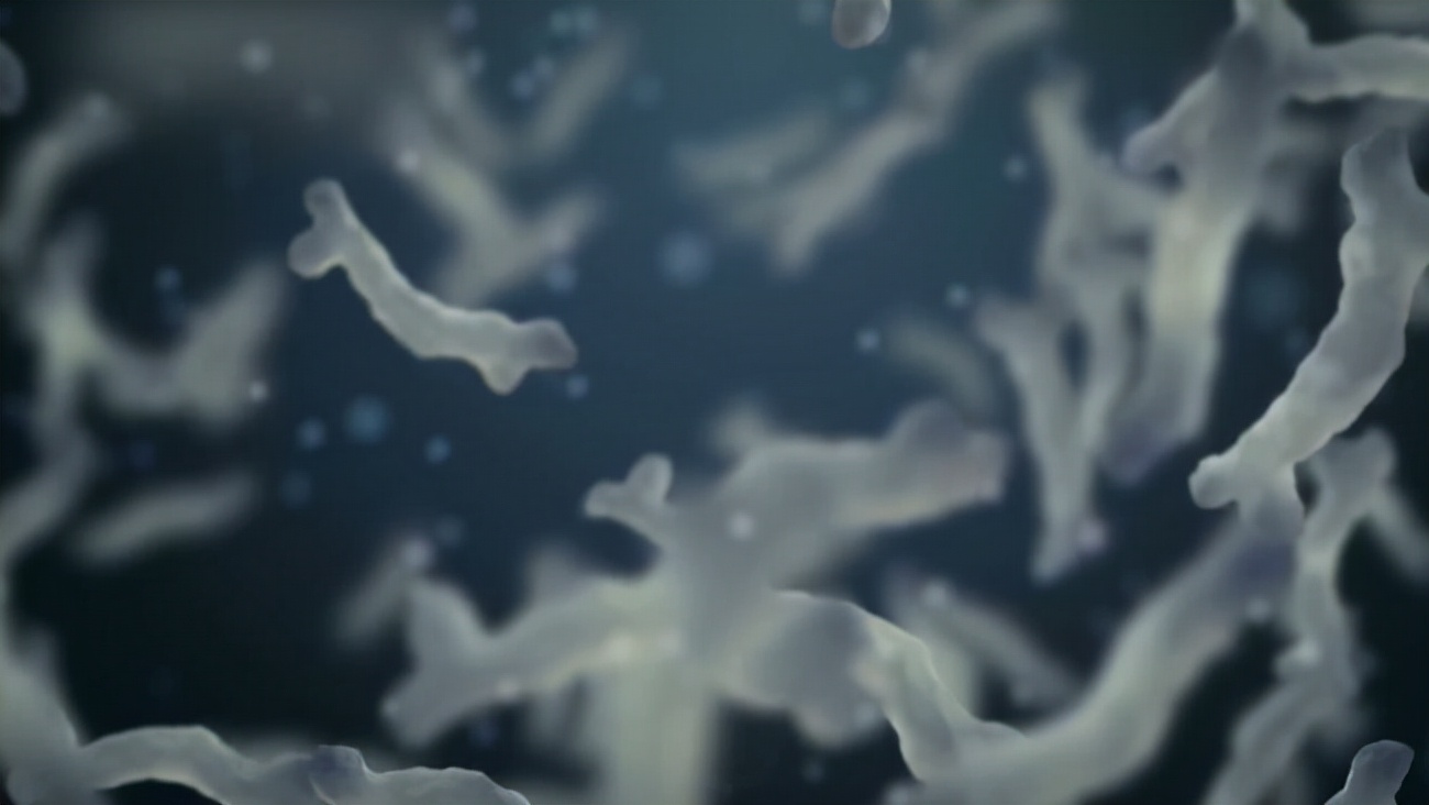 What is the "mud" in the belly button, can it be removed?The microscope ...