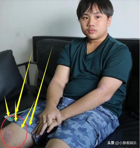 He made his debut at the age of 2 to earn money. Today, 17-year-old ...