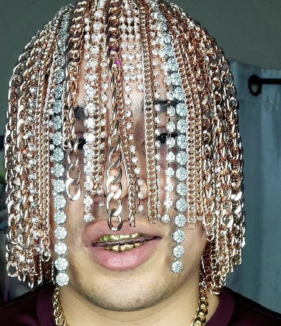 The 23-year-old actor underwent surgery and planted gold chains all ...