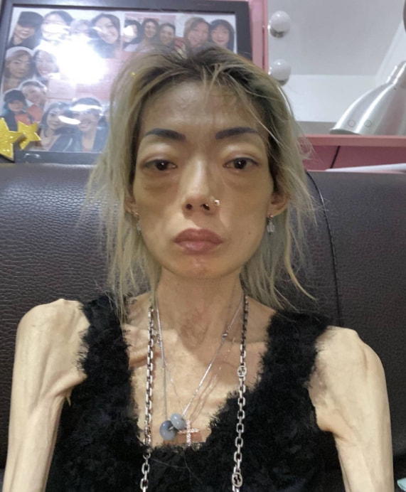 A 22-year-old supermodel married to a wealthy family, she lost 44 ...