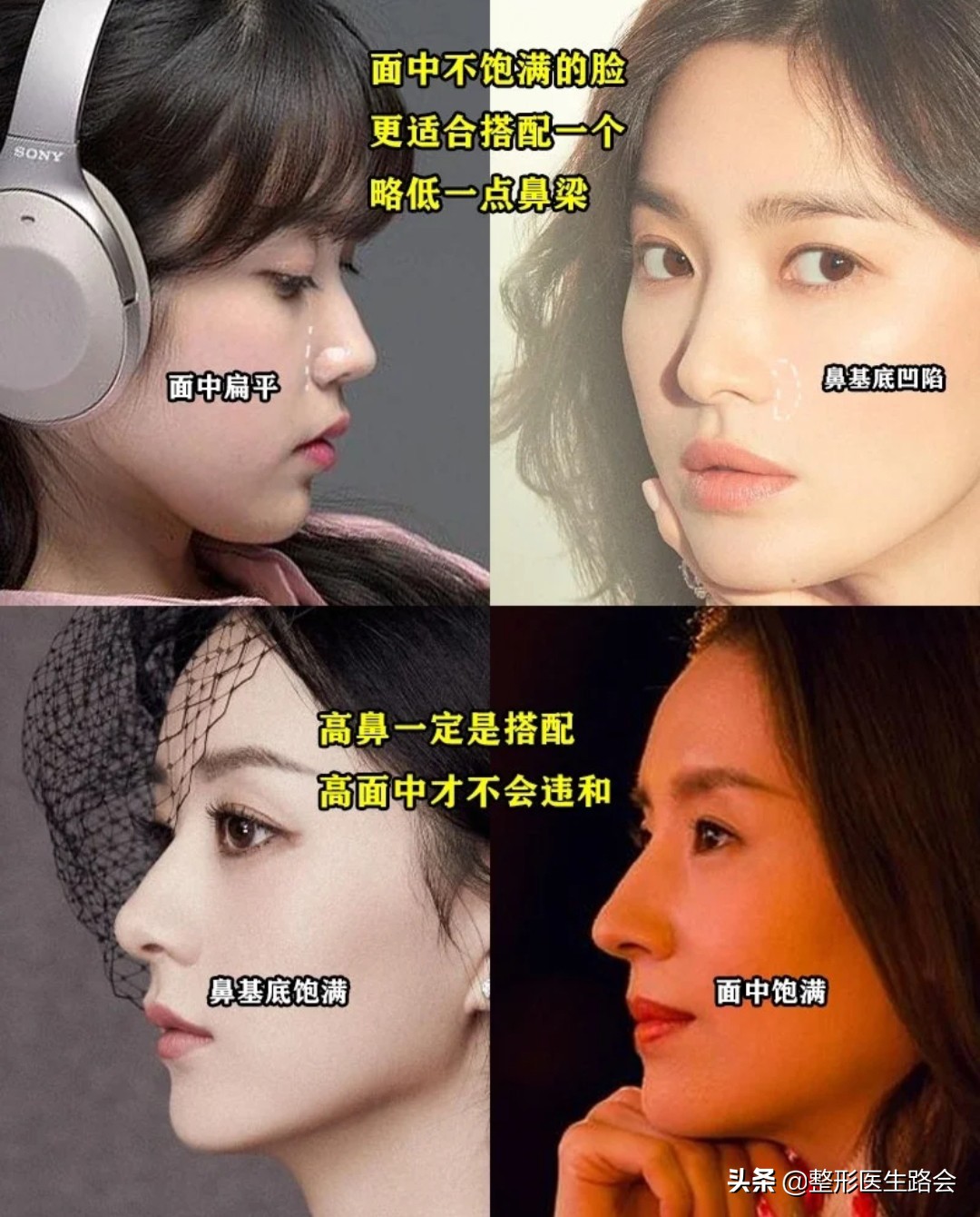 Straight nose, straight nose slightly curled, curled nose, slightly ...