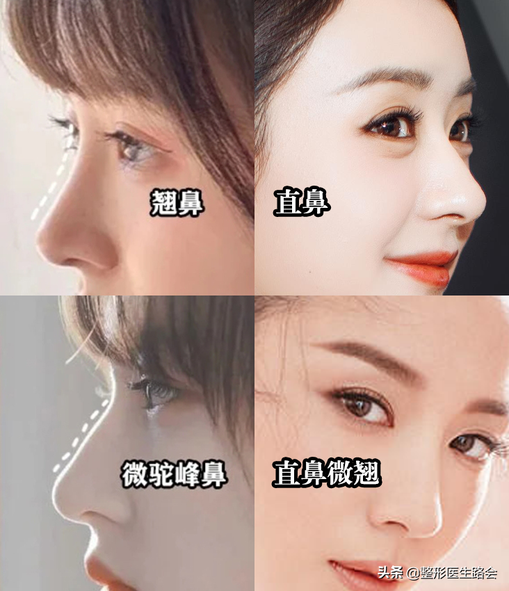 Straight nose, straight nose slightly curled, curled nose, slightly ...