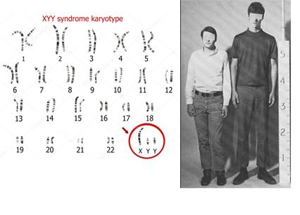The male chromosome is XY, and the female is XX. What would a person ...