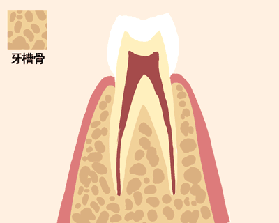 Planting a tooth, why have to treat periodontal disease? - iNEWS