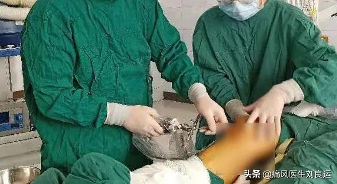 Do gout patients all grow tophi?The doctor introduces four methods of ...
