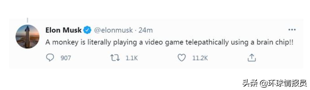 The future is here!Musk's brain-computer interface is implanted in ...