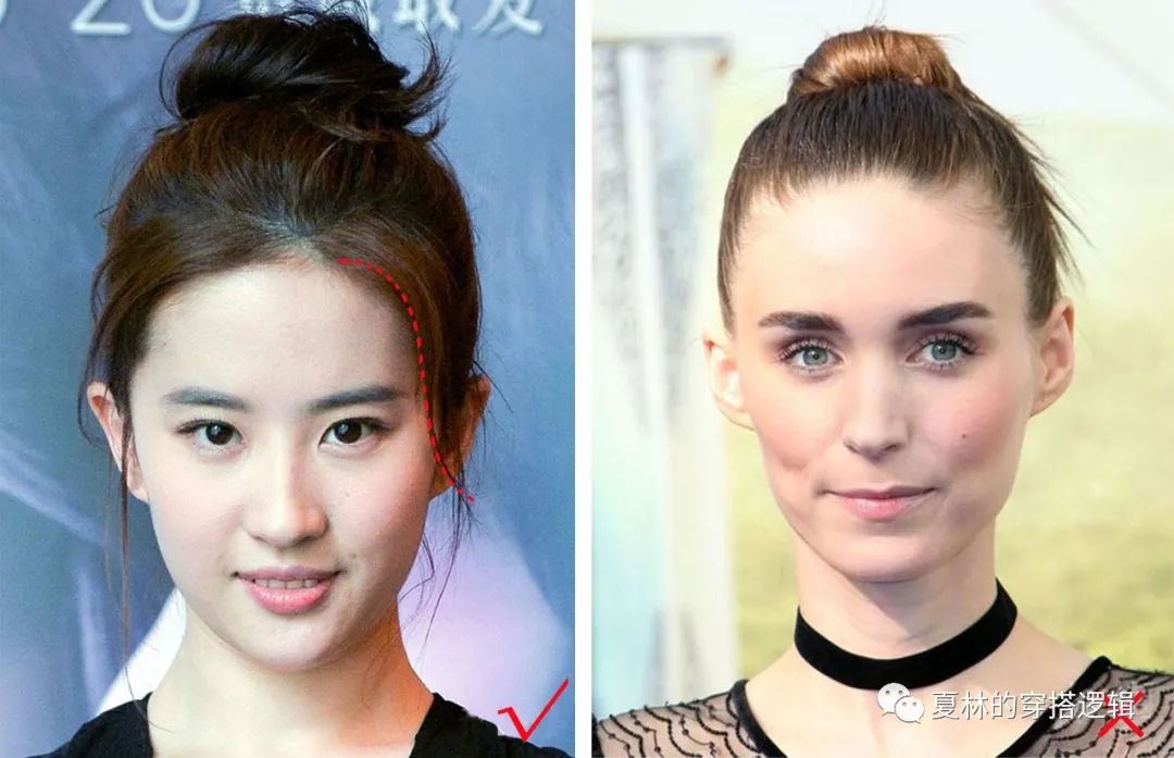 How to save sunken temples and external cheekbones - iNEWS