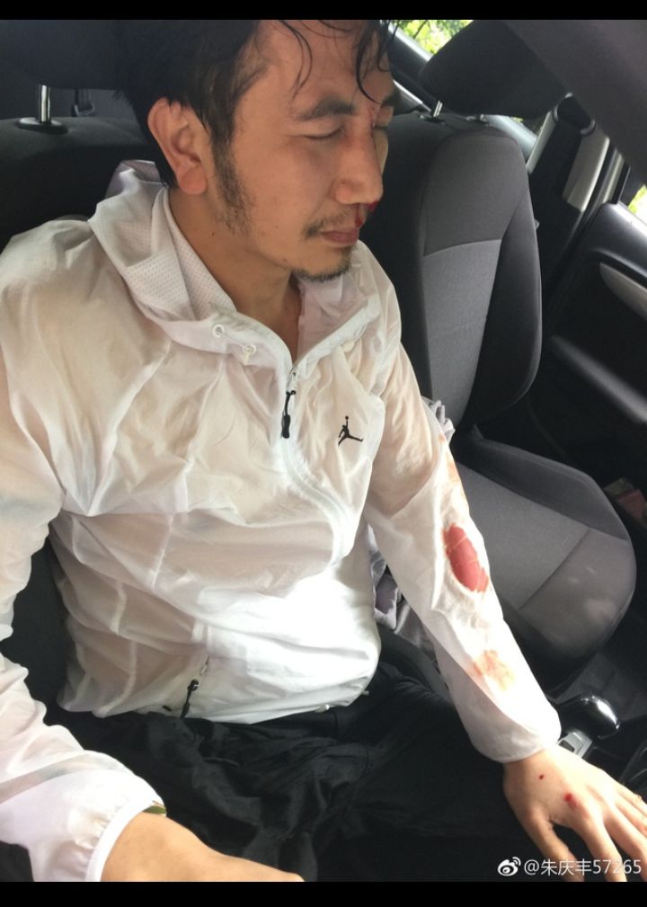 Song Zude calls on Venus to speak up for Lin Shengbin's incident - iNEWS