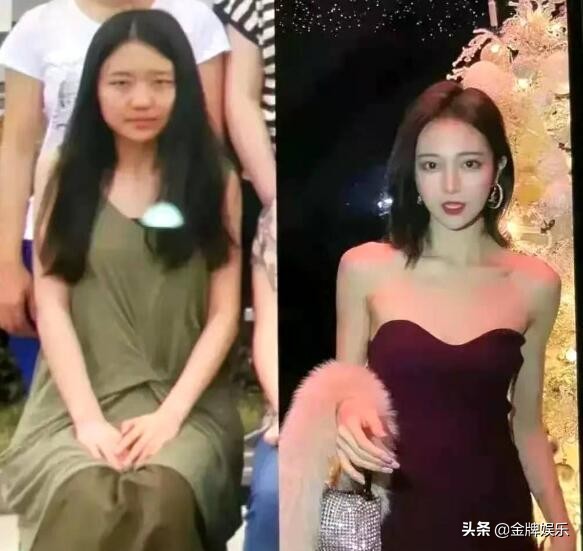 Wang Sixing's 10-year plastic surgery road!In the past, it was the ugly ...