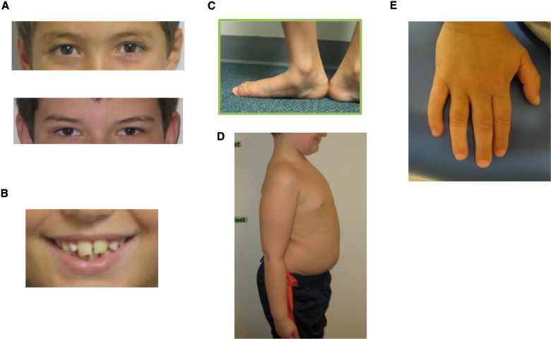 What happens if a man has an extra Y chromosome?1 in 1,000, more man ...