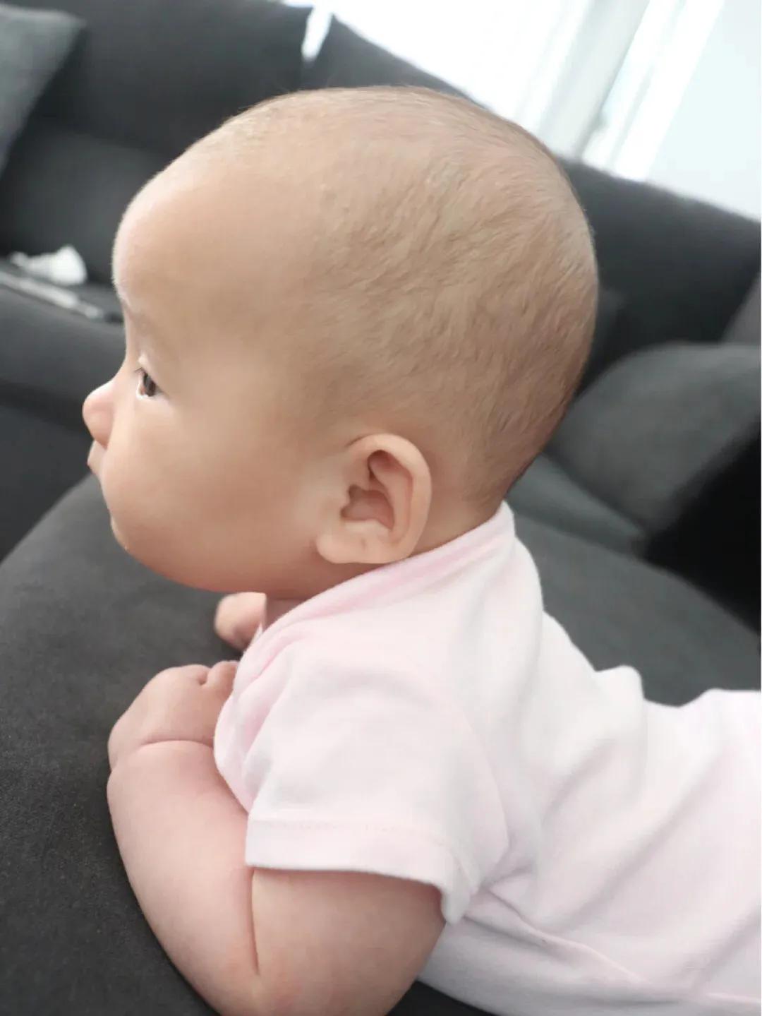 How to give your baby a good head shape!Scaphoid head correction - iNEWS