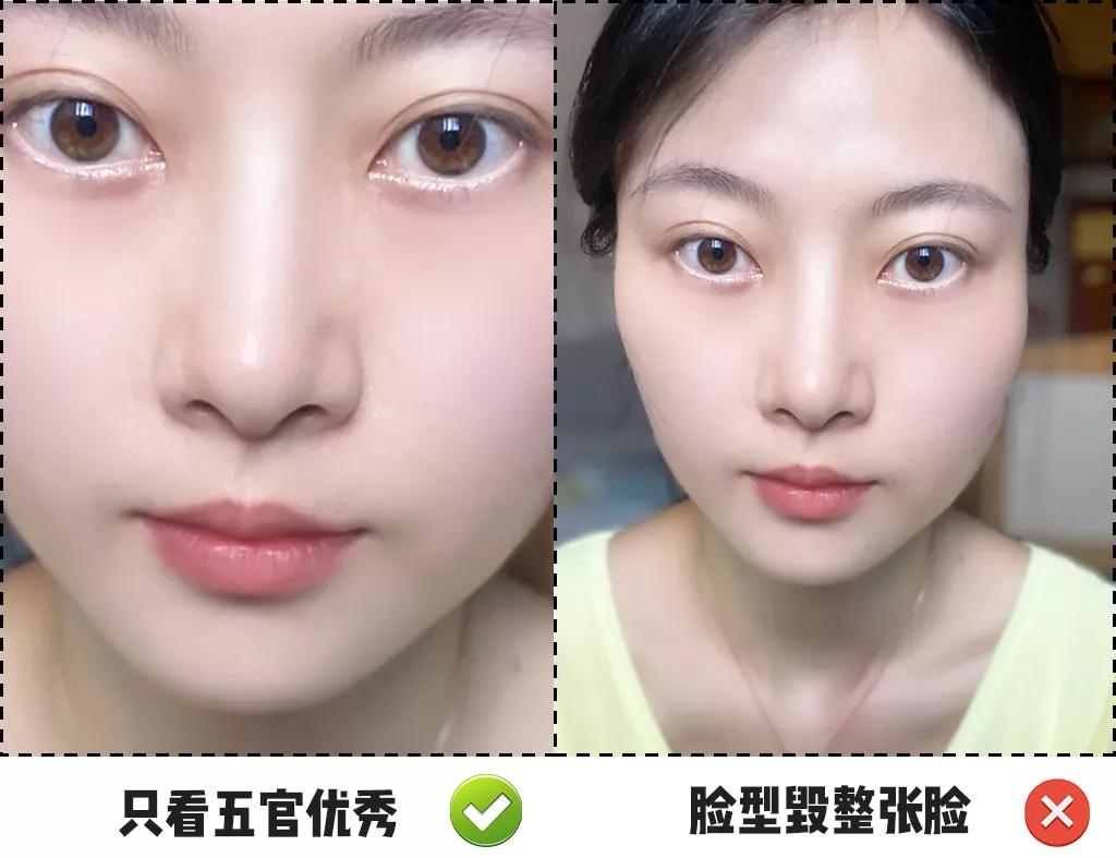 This face shape affects the appearance too much, how to solve it? - iNEWS