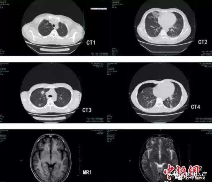 How do imaging doctors diagnose this strange disease caused by eating ...