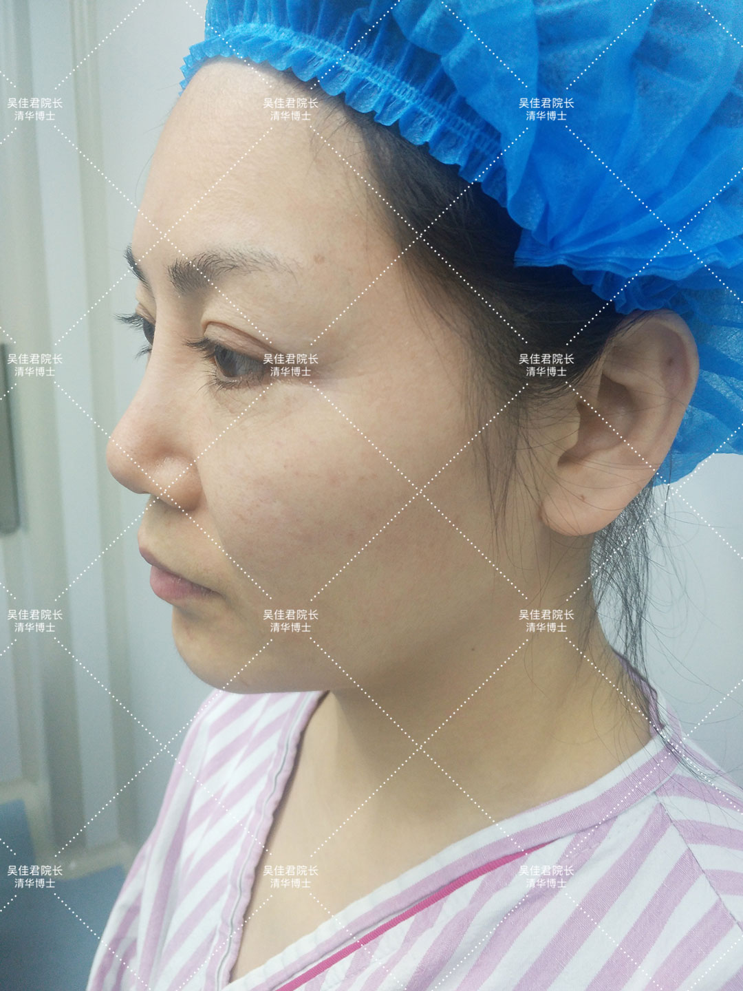 In her 30s, her face collapsed like a 50-year-old aunt. She ...