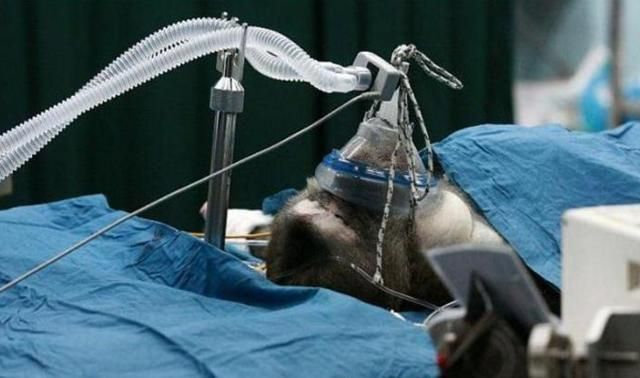 In 1984, a baby girl in the United States was successfully transplanted ...